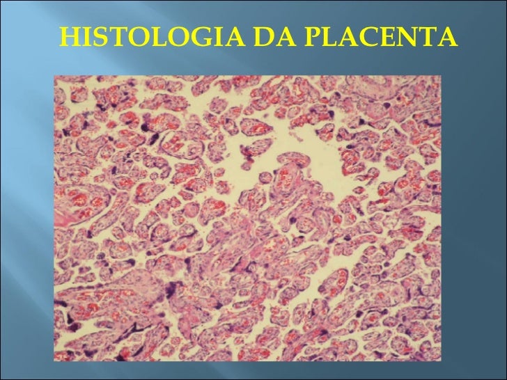 Histologia Da Placenta