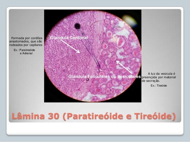 Modelo De Anatomia Da Glandula Tireoide Histologia 2