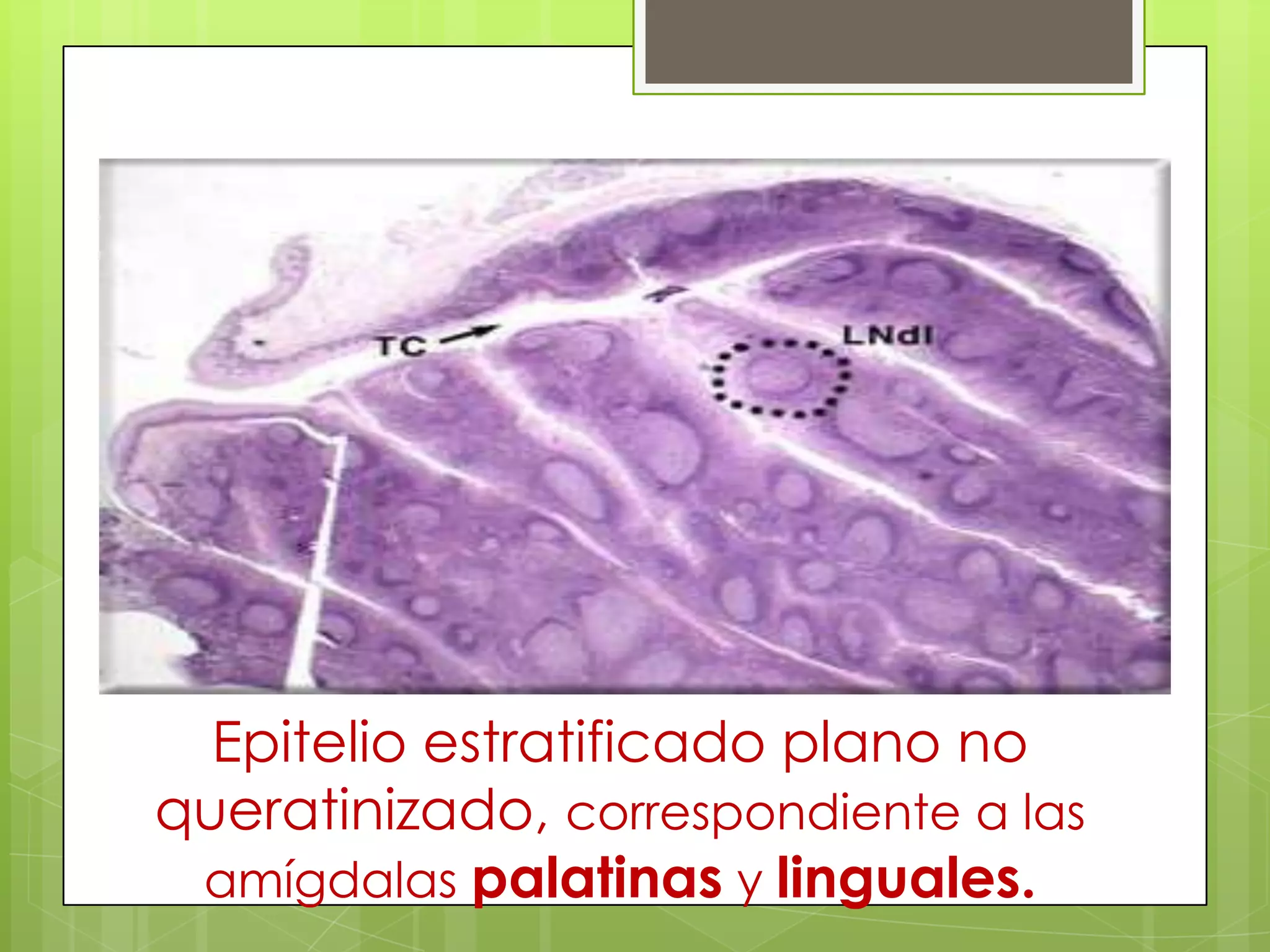 Histologia amigdalas | PPTX | Ear, Nose and Throat Conditions ...