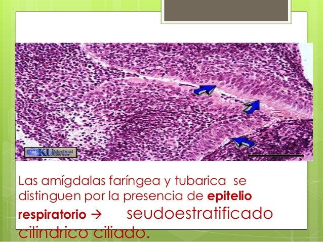 Diagrama De Amigdalas 100 Milliards De Neurones: LE CERVEAU D'UN