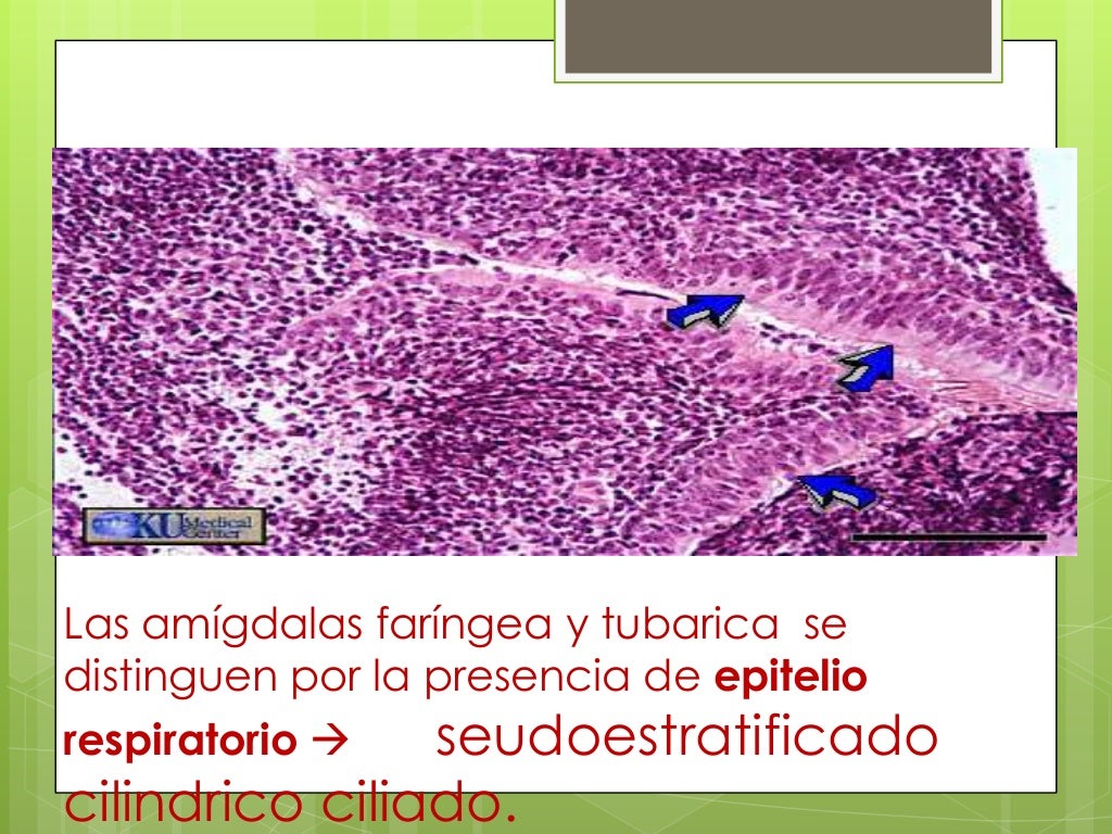 Slide De Histologia Das Amigdalas Sistema Imune – Histologia De