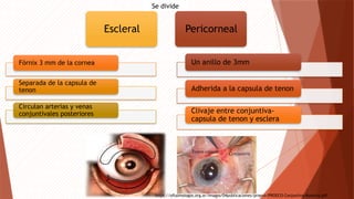 histologia conjuntiva y esclera histologia conjuntiva y esclera | PPTX