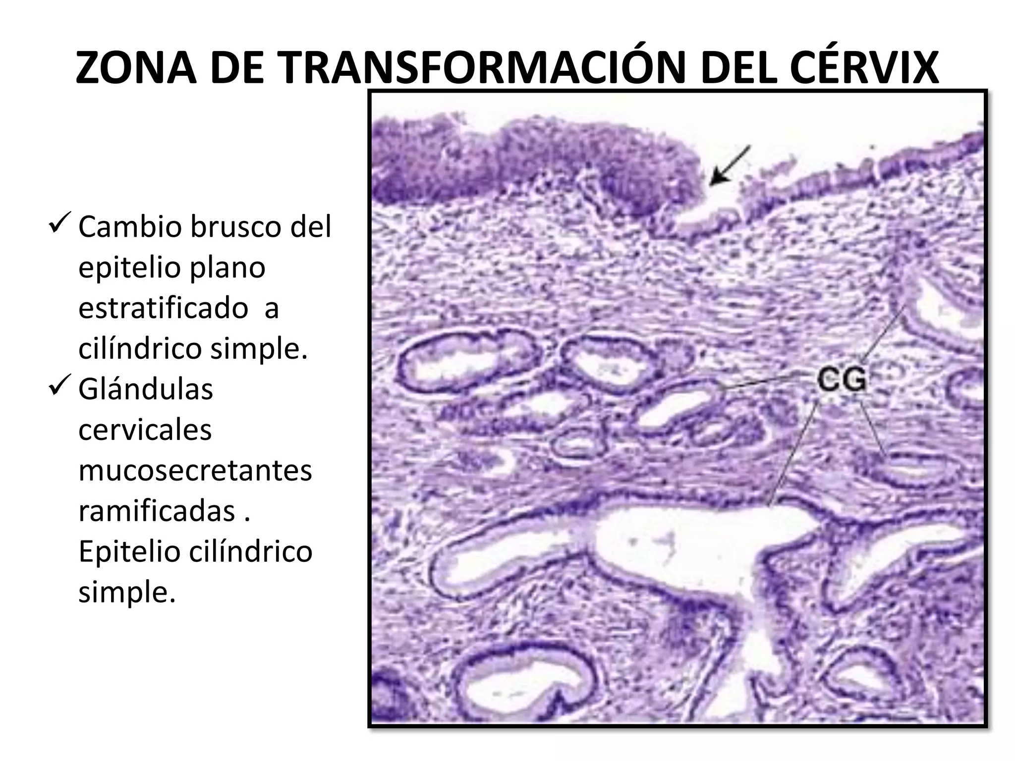 Histologia del cervix