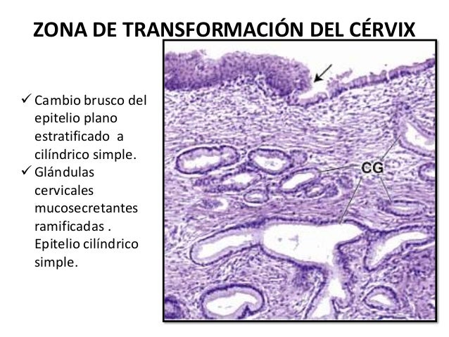 Histologia del cervix