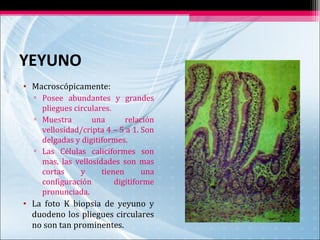 Histologia estomago,duodeno y yeyuno | PPT