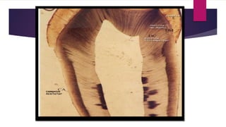HISTOLOGÍA Y FISIOLOGIA DEL COMPLEJO DENTINO-PULPAR.pptx