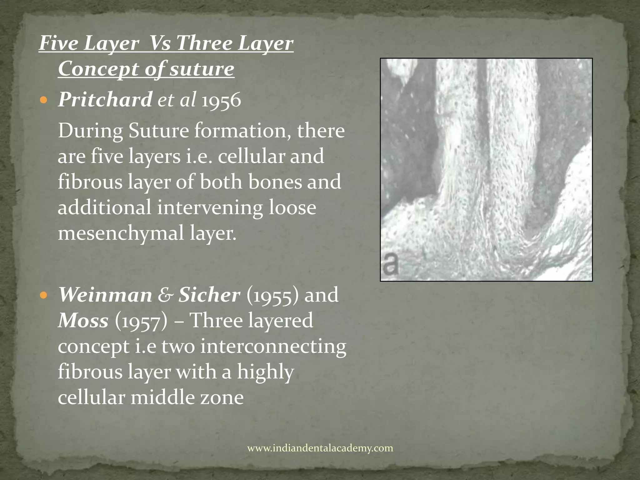 Histological changes in dentofacial orthopaedics1 /certified fixed ...