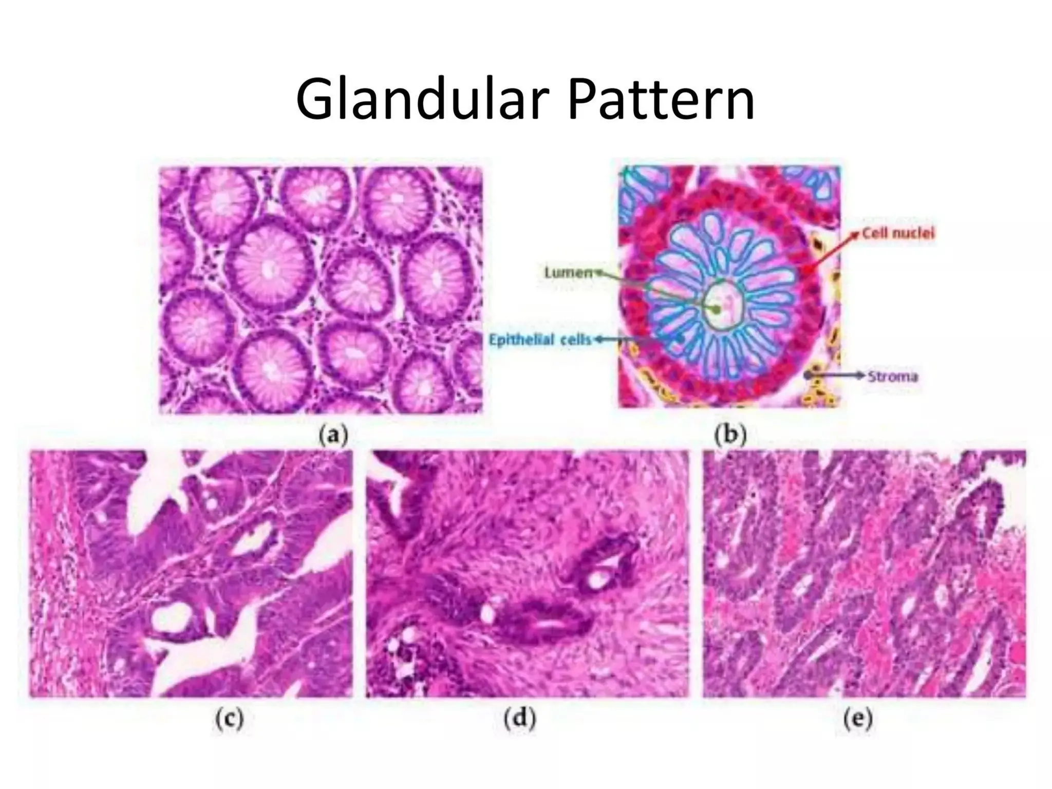 HISTOLOGICAL PATTERN.pptx is histology patterns | PPT