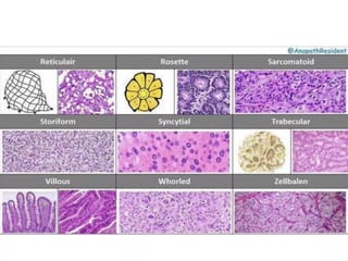 HISTOLOGICAL PATTERN.pptx is histology patterns | PPTX