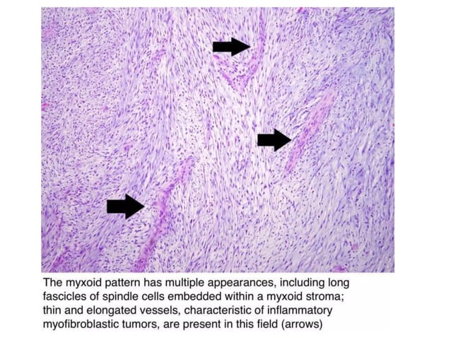 HISTOLOGICAL PATTERN.pptx is histology patterns | PPT