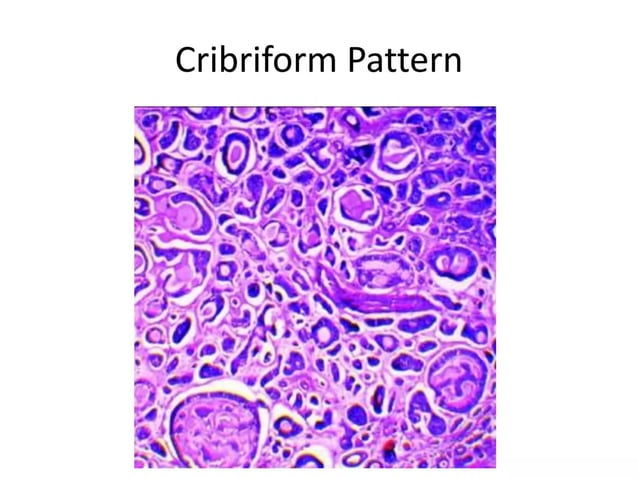 HISTOLOGICAL PATTERN.pptx is histology patterns | PPT