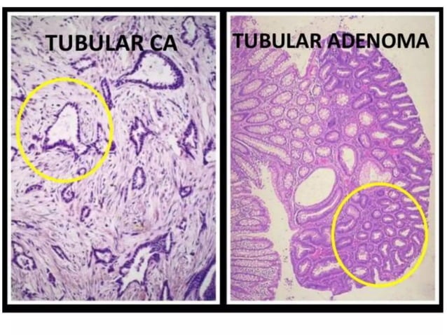 HISTOLOGICAL PATTERN.pptx is histology patterns | PPT