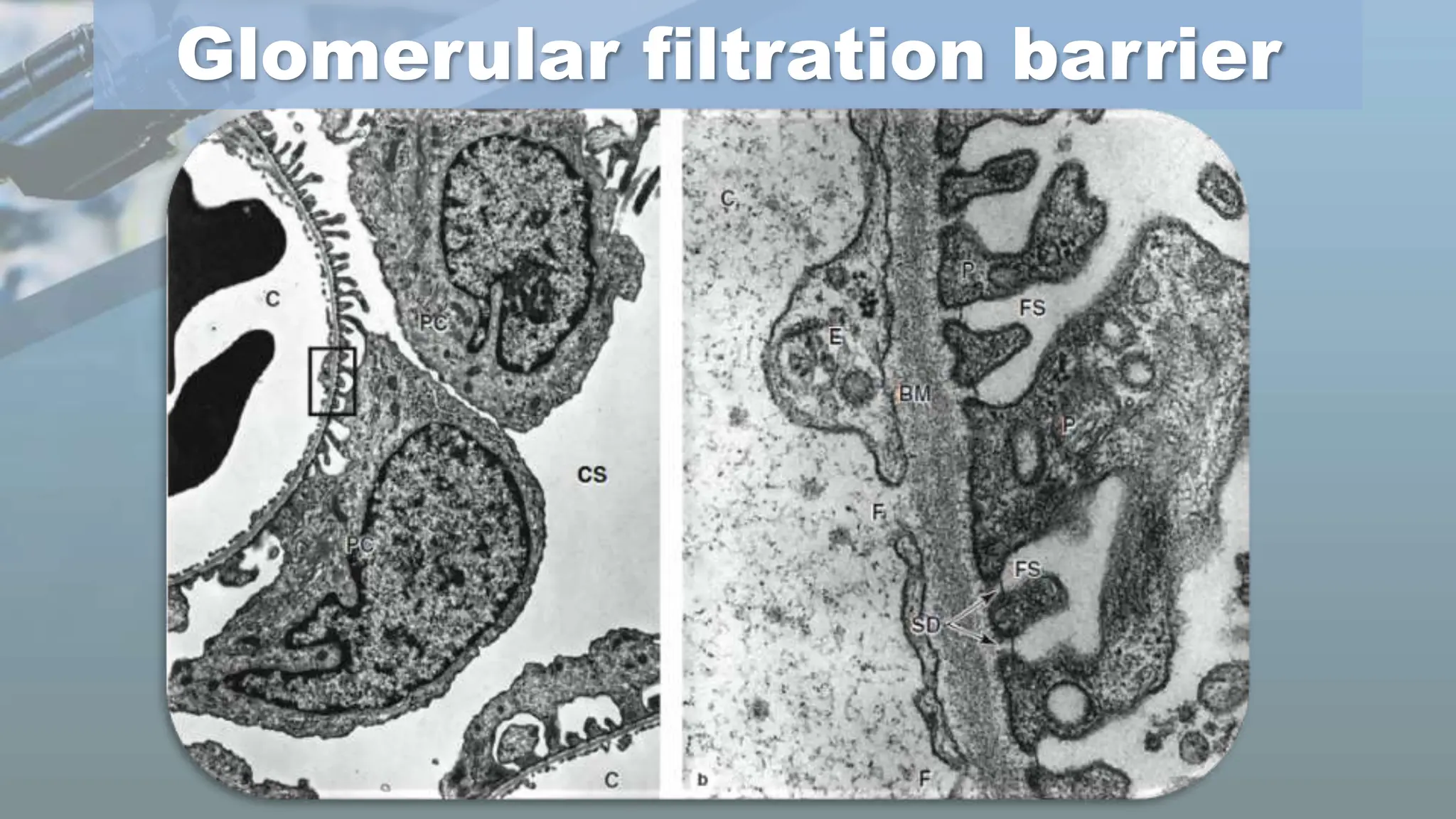 Histological Structure of The Renal Corpuscle Suits its function- maha ...