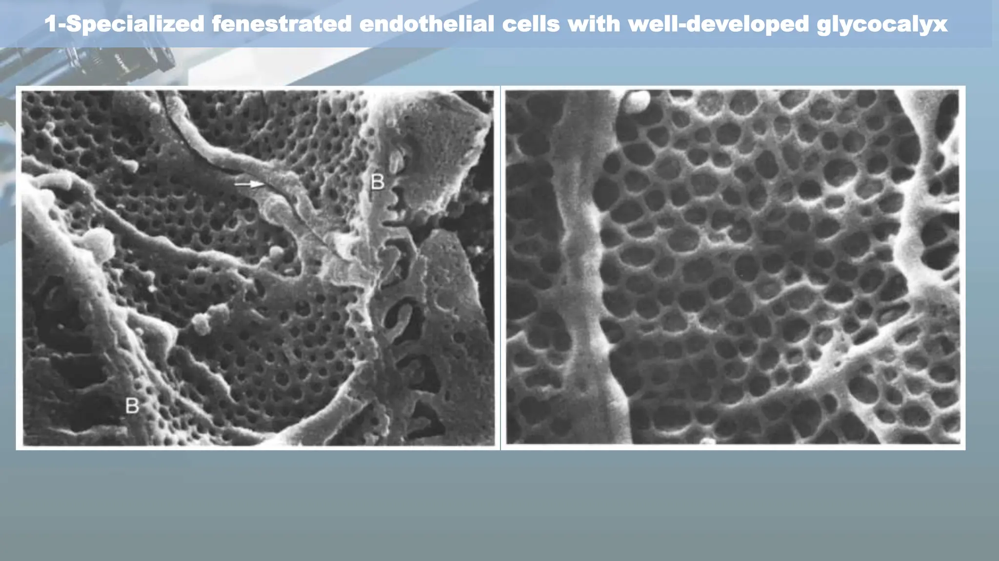 Histological Structure of The Renal Corpuscle Suits its function- maha ...