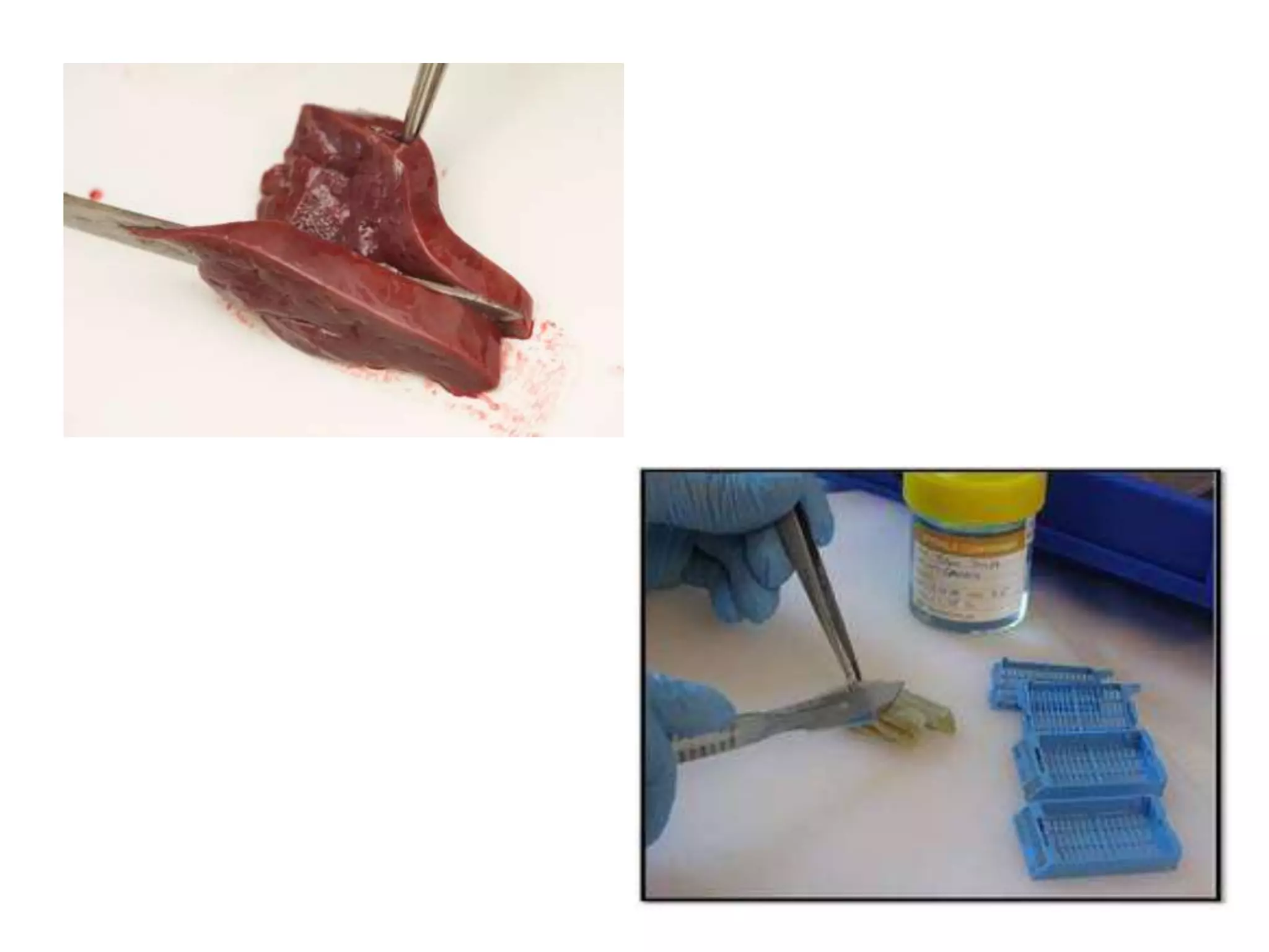 Histological Techniques: Section 1:Tissue collection and Grossing | PPTX