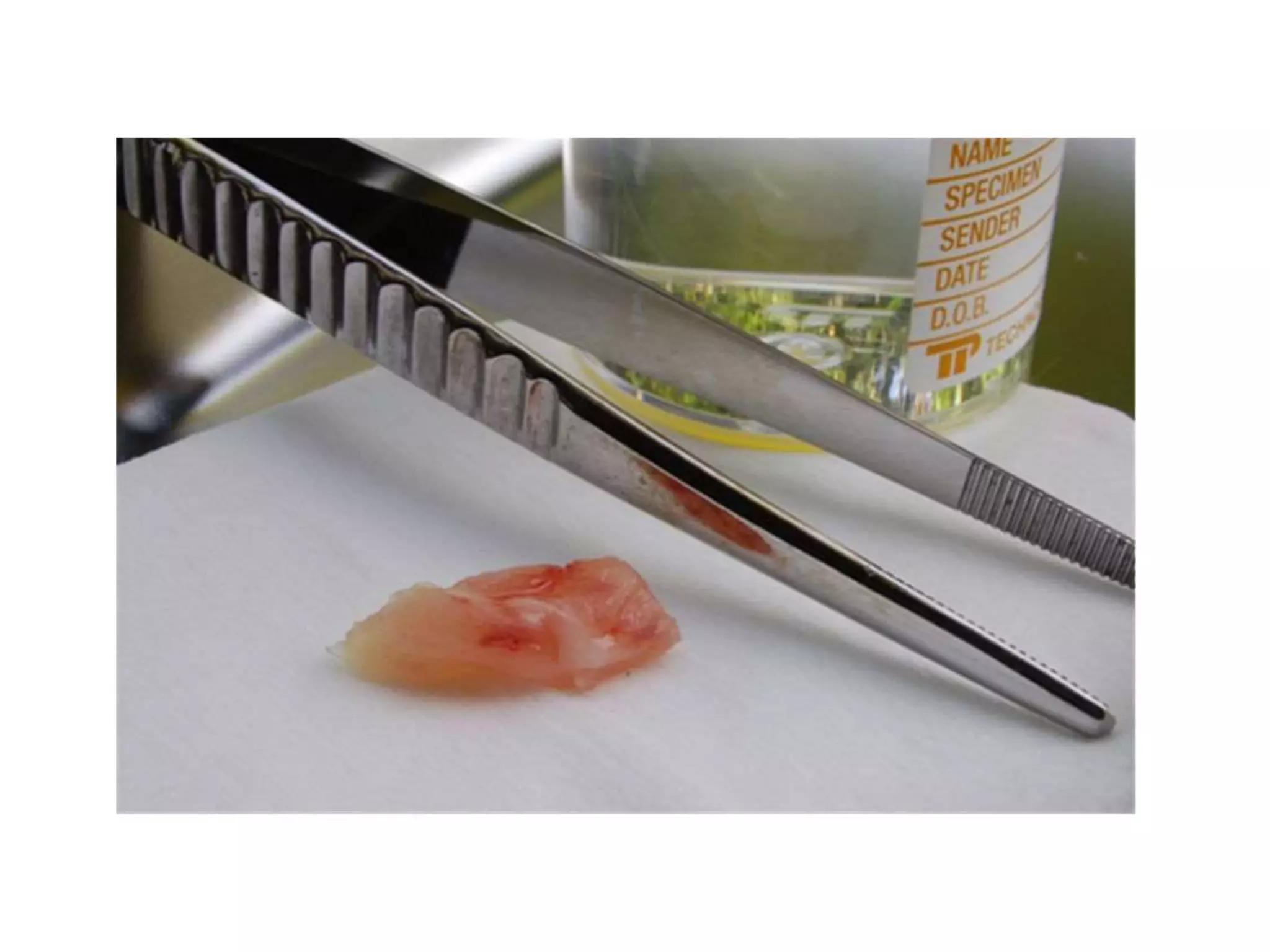 Histological Techniques: Section 1:Tissue collection and Grossing | PPTX