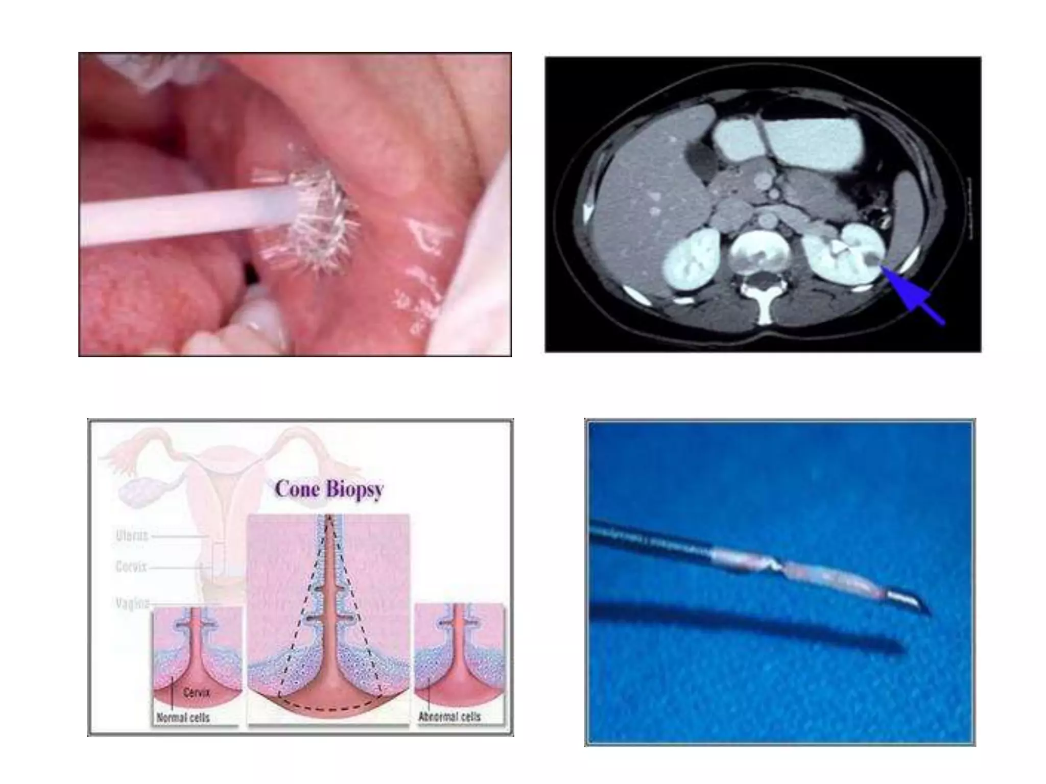 Histological Techniques: Section 1:Tissue collection and Grossing | PPTX