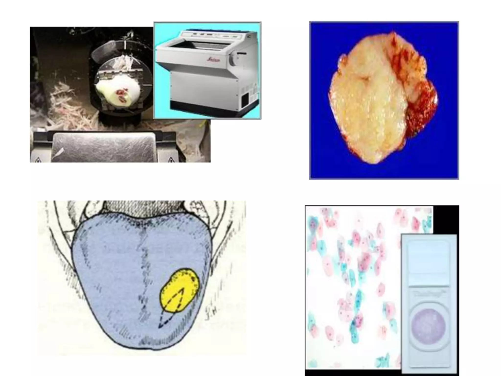 Histological Techniques: Section 1:Tissue collection and Grossing | PPTX