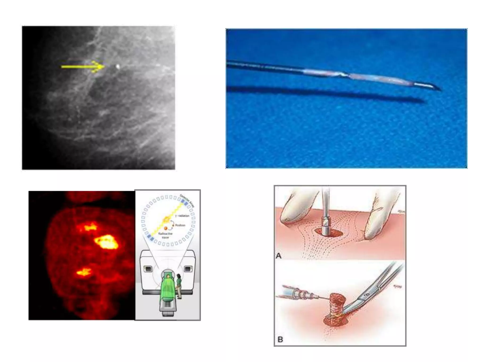 Histological Techniques: Section 1:Tissue collection and Grossing | PPTX
