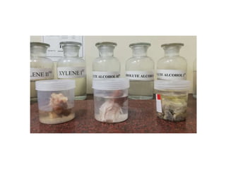 Histological Techniques: Section 1:Tissue collection and Grossing | PPTX