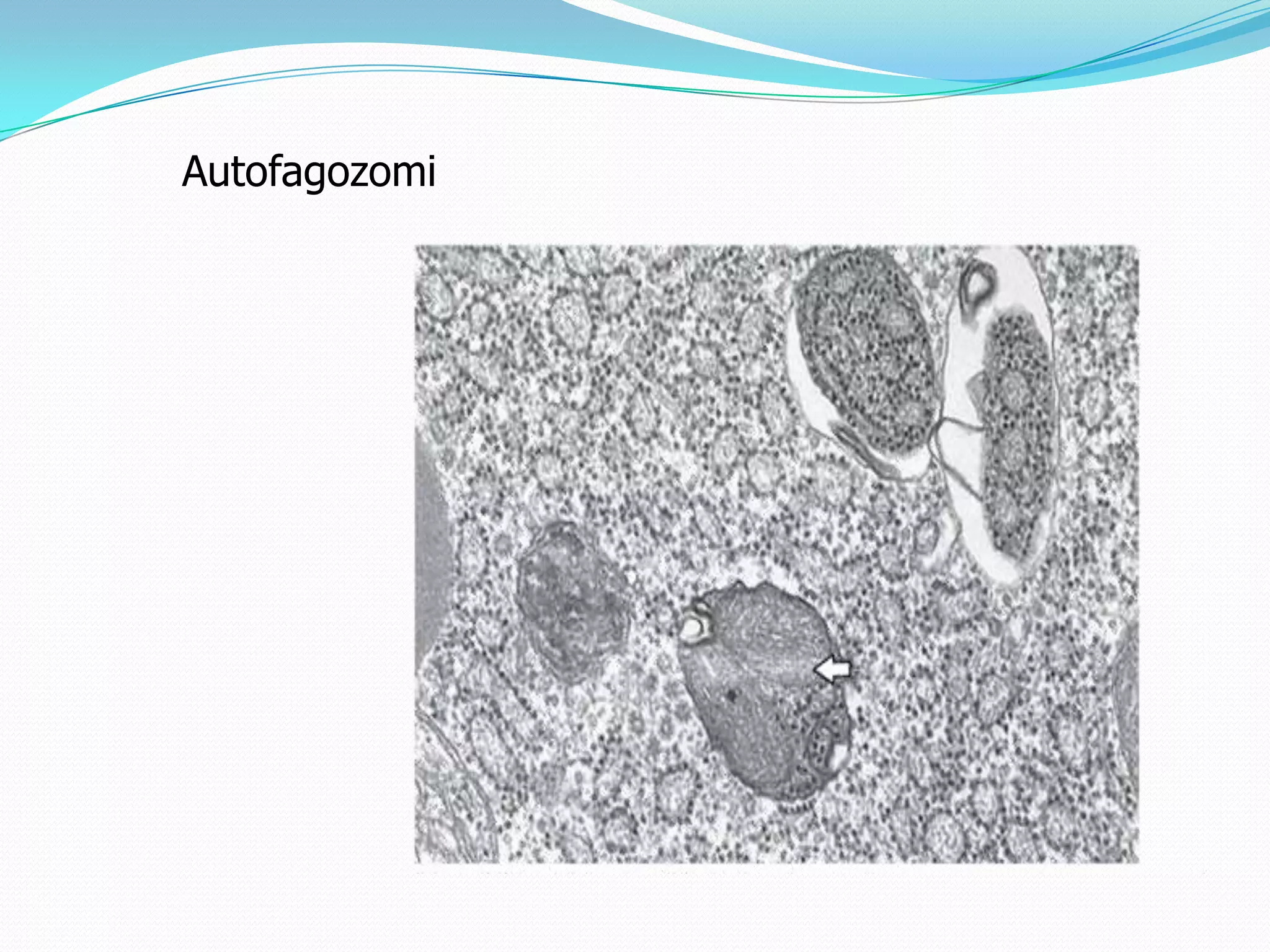 Histologija - Golgi i lizozomi | PPTX