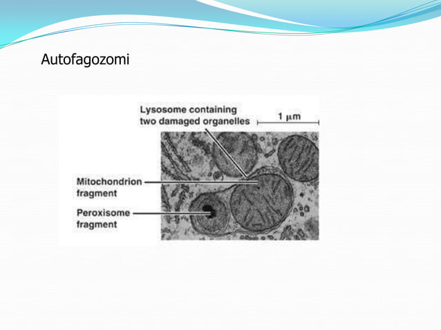 Histologija - Golgi i lizozomi | PPT