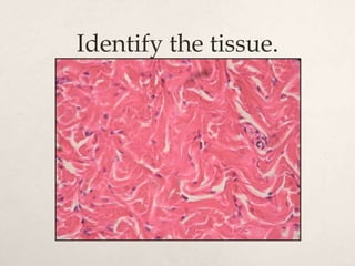 Connective Tissue Slides Quiz
