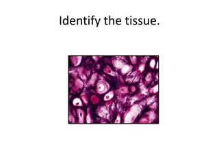 Connective Tissue Slides Quiz