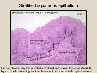 Transitional Epithelium Labeled Basement Membrane