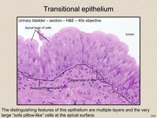 Transitional Epithelium Labeled Basement Membrane