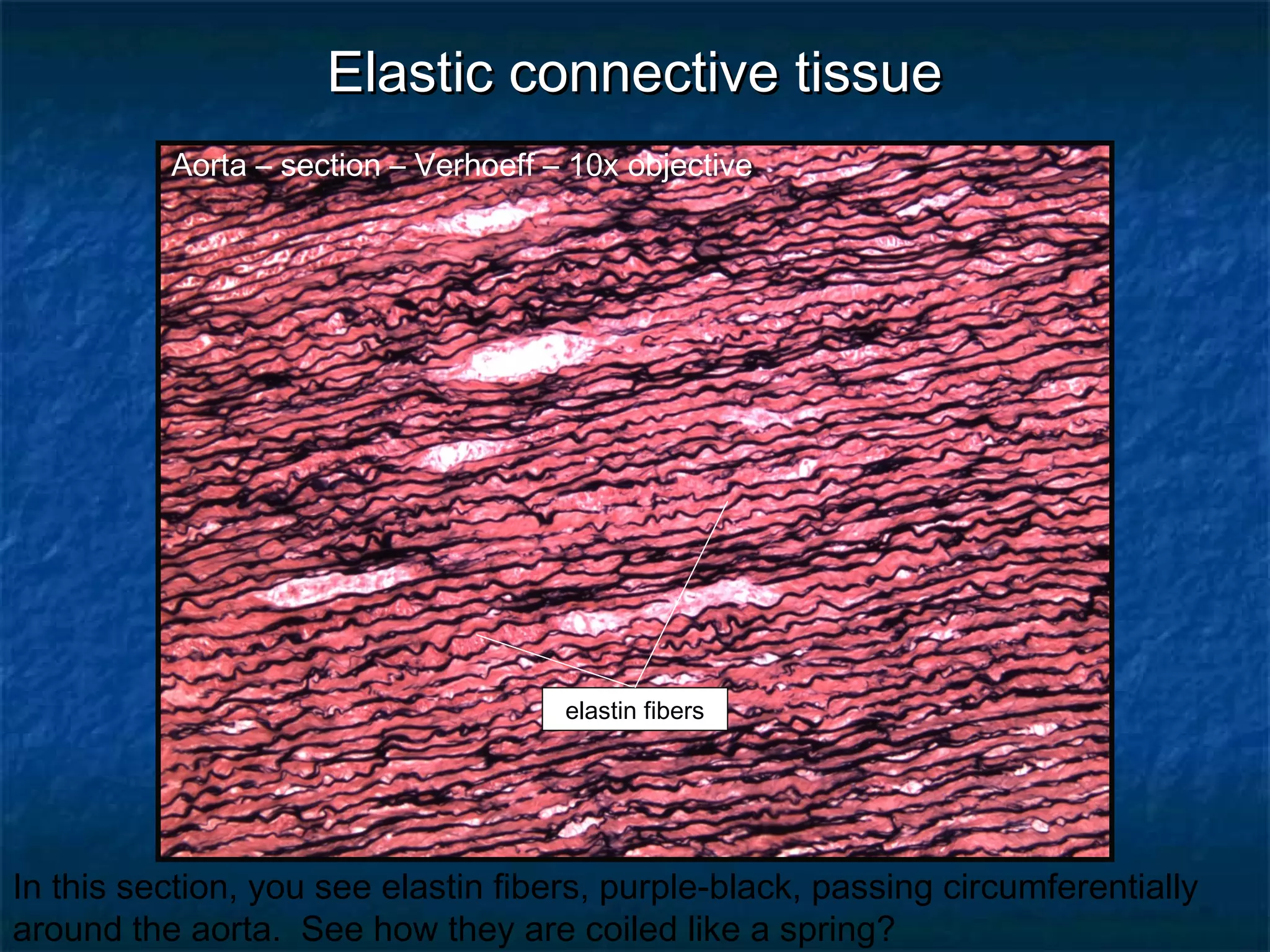 Histology: Connective Tissues | PPT