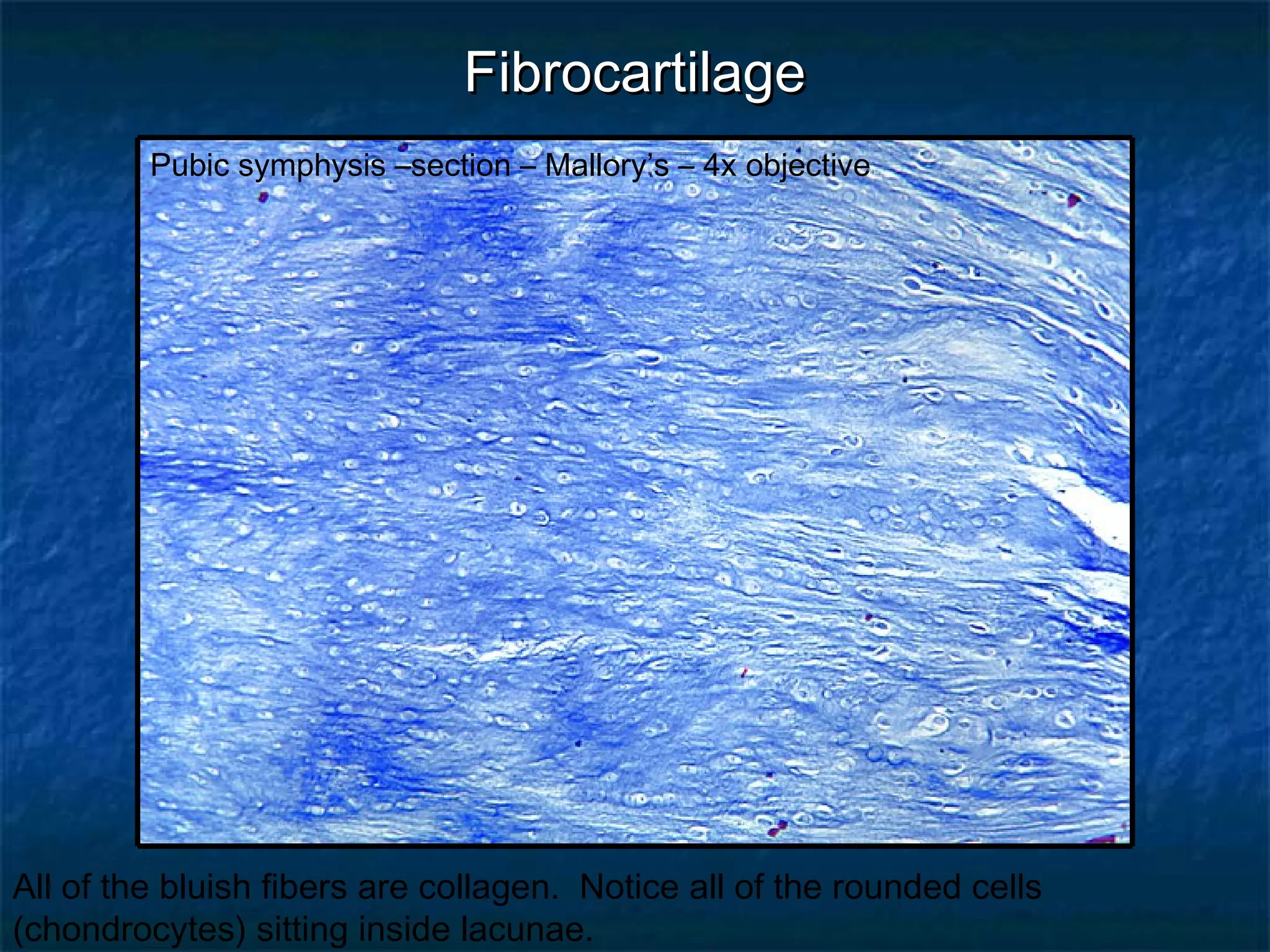 Histology: Connective Tissues | PPT