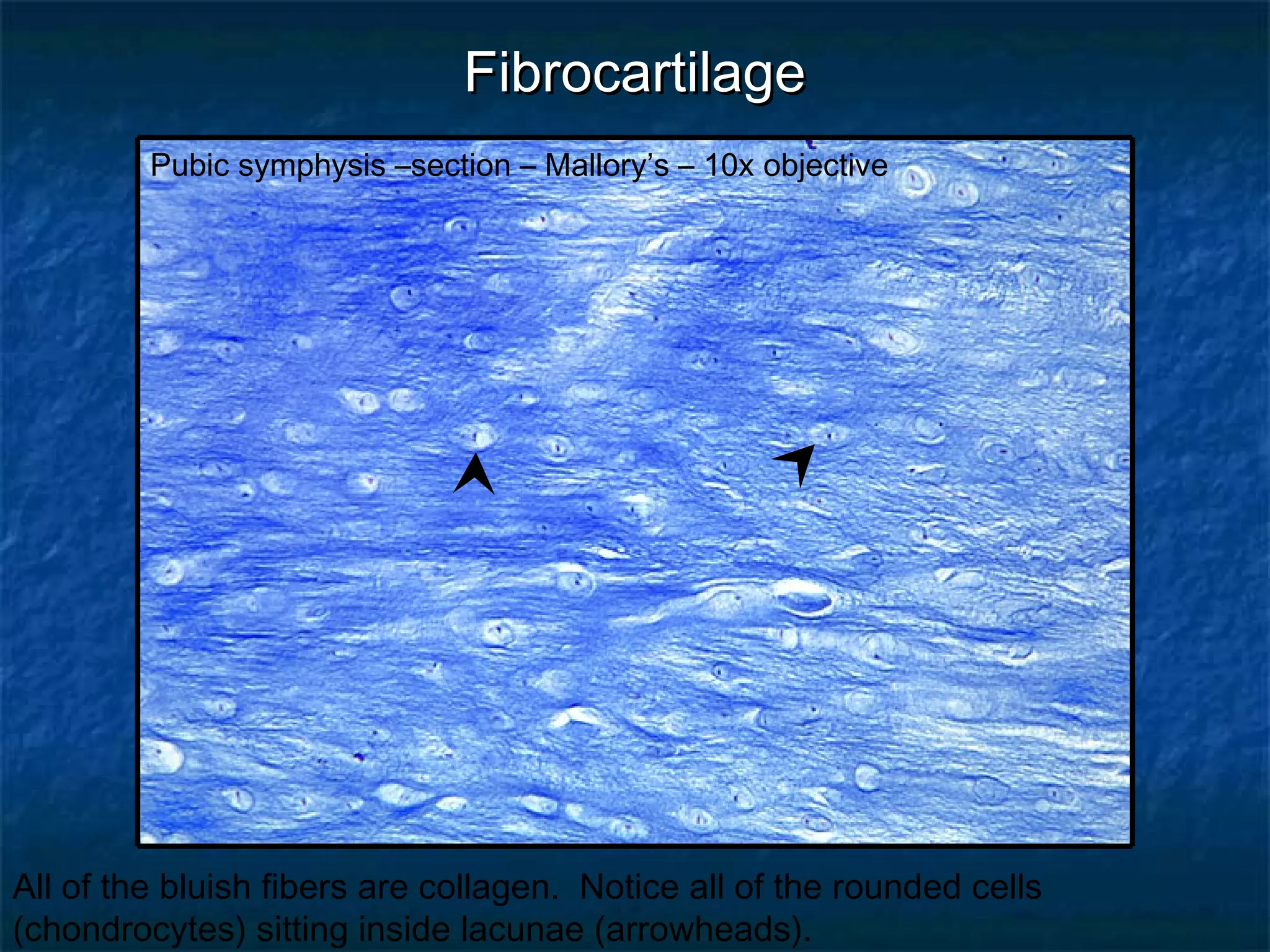 Histology: Connective Tissues | PPT