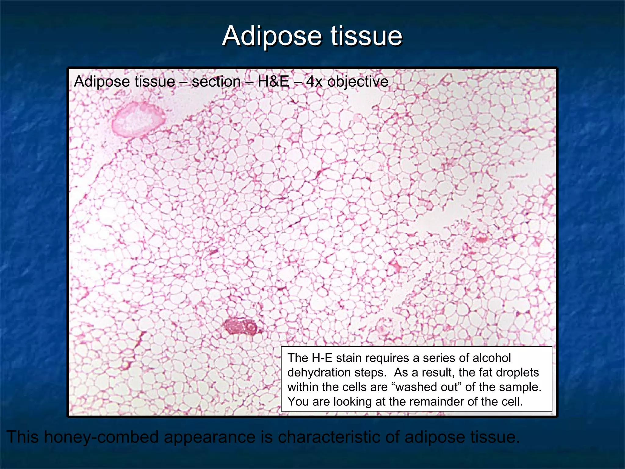 Histology: Connective Tissues | PPT