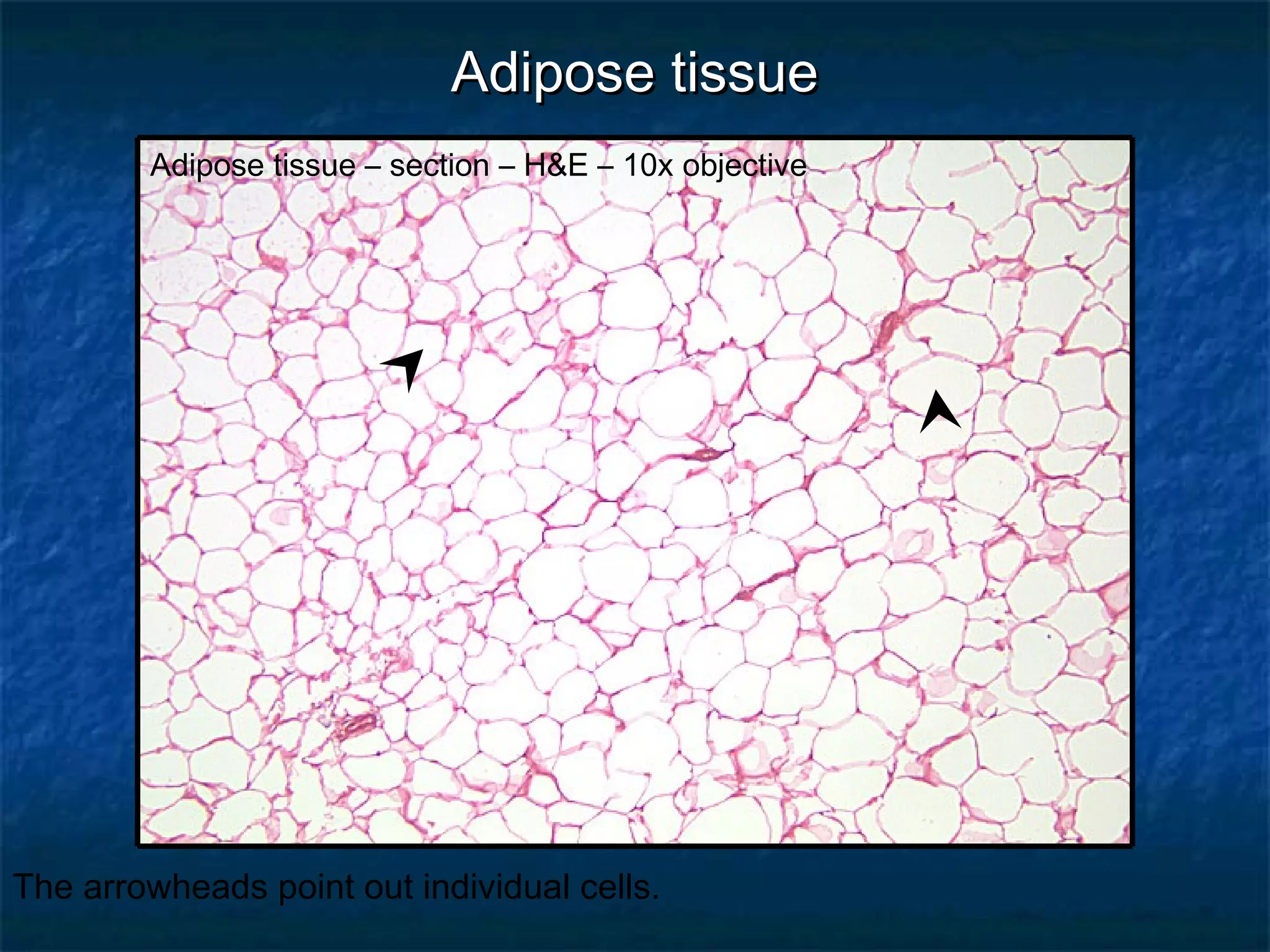 Histology: Connective Tissues | PPT