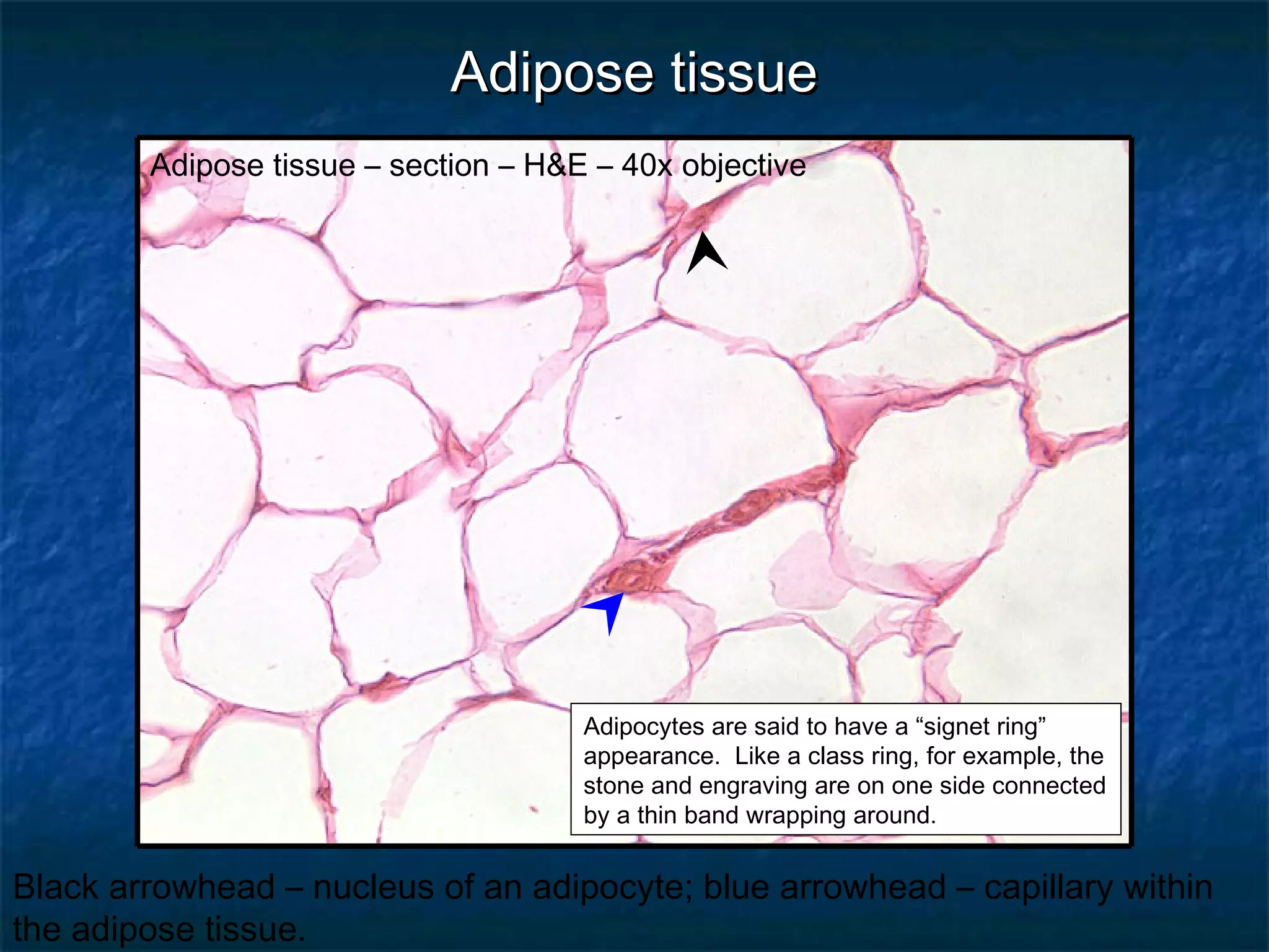 Histology: Connective Tissues | PPT