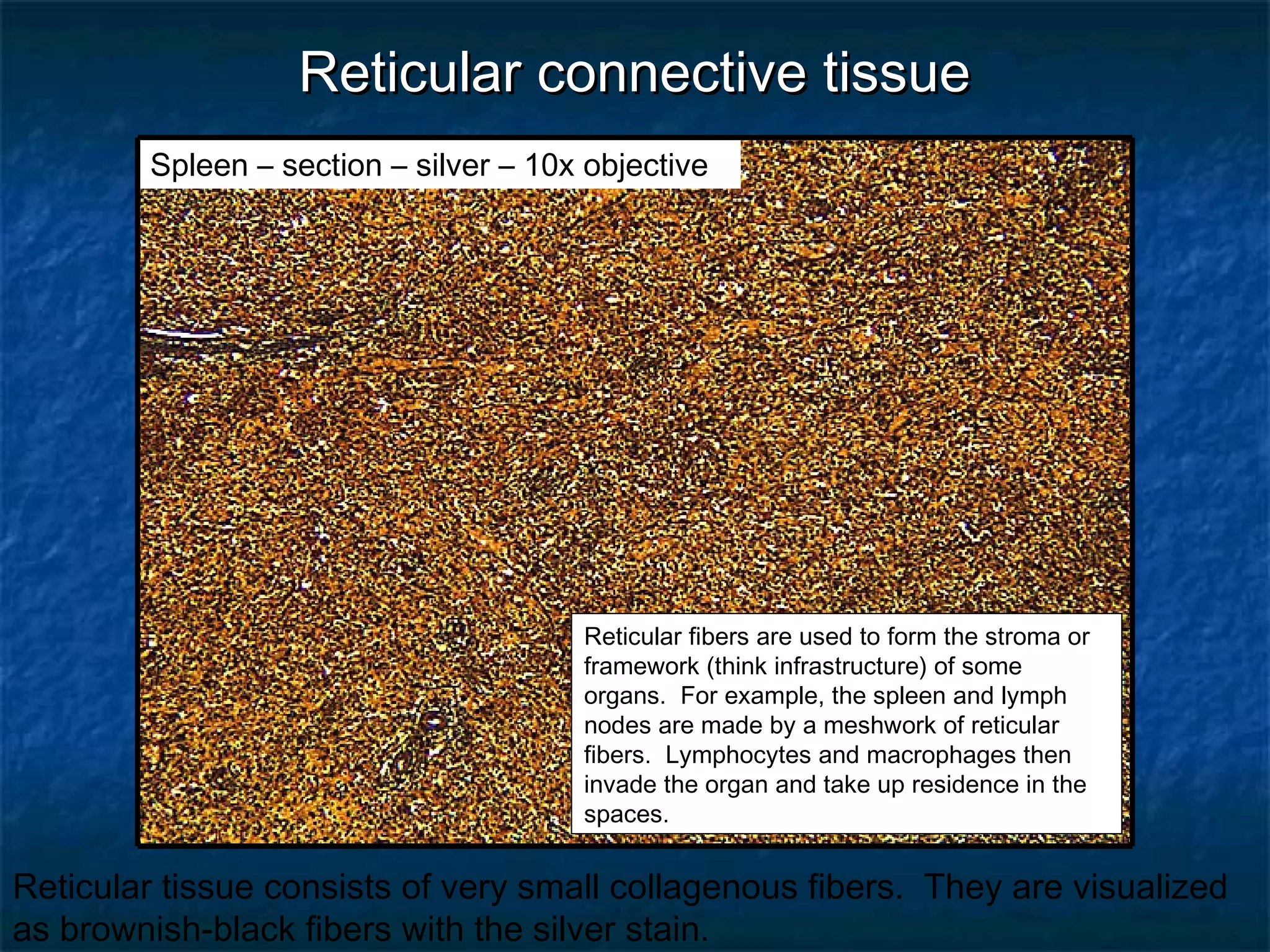 Histology: Connective Tissues | PPT