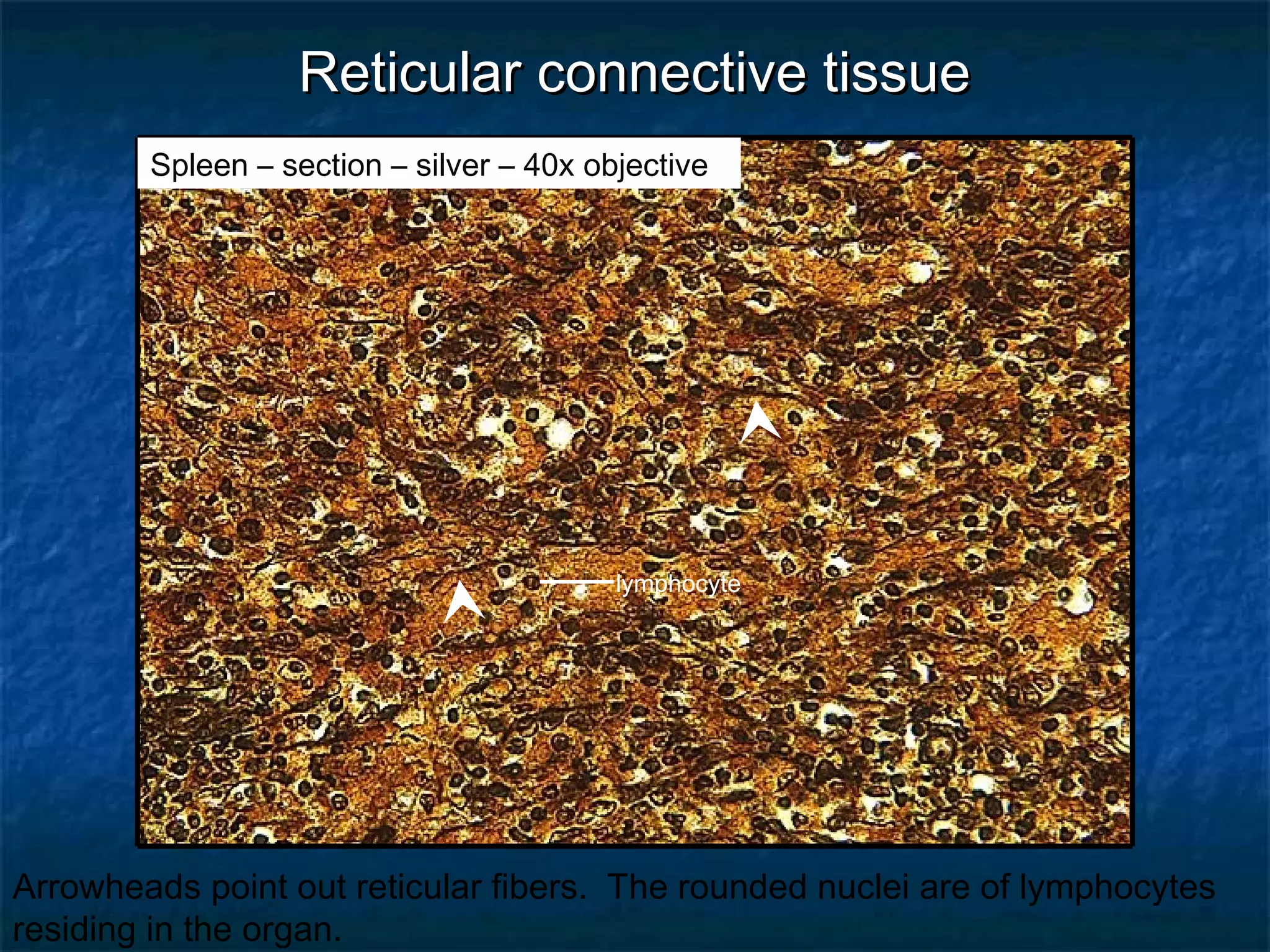 Histology: Connective Tissues | PPT