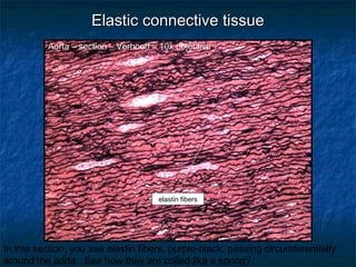 Histology: Connective Tissues | PPT