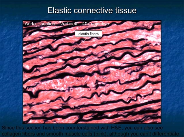 Histology: Connective Tissues | PPT