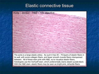 Elastic Connective Tissue Slide