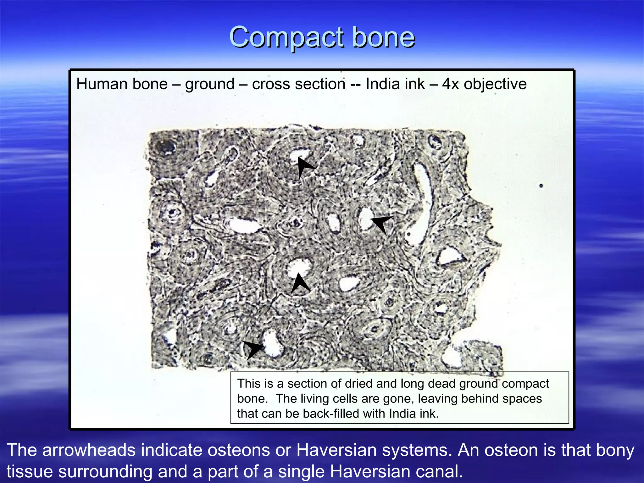 Histology: Bone | PPT