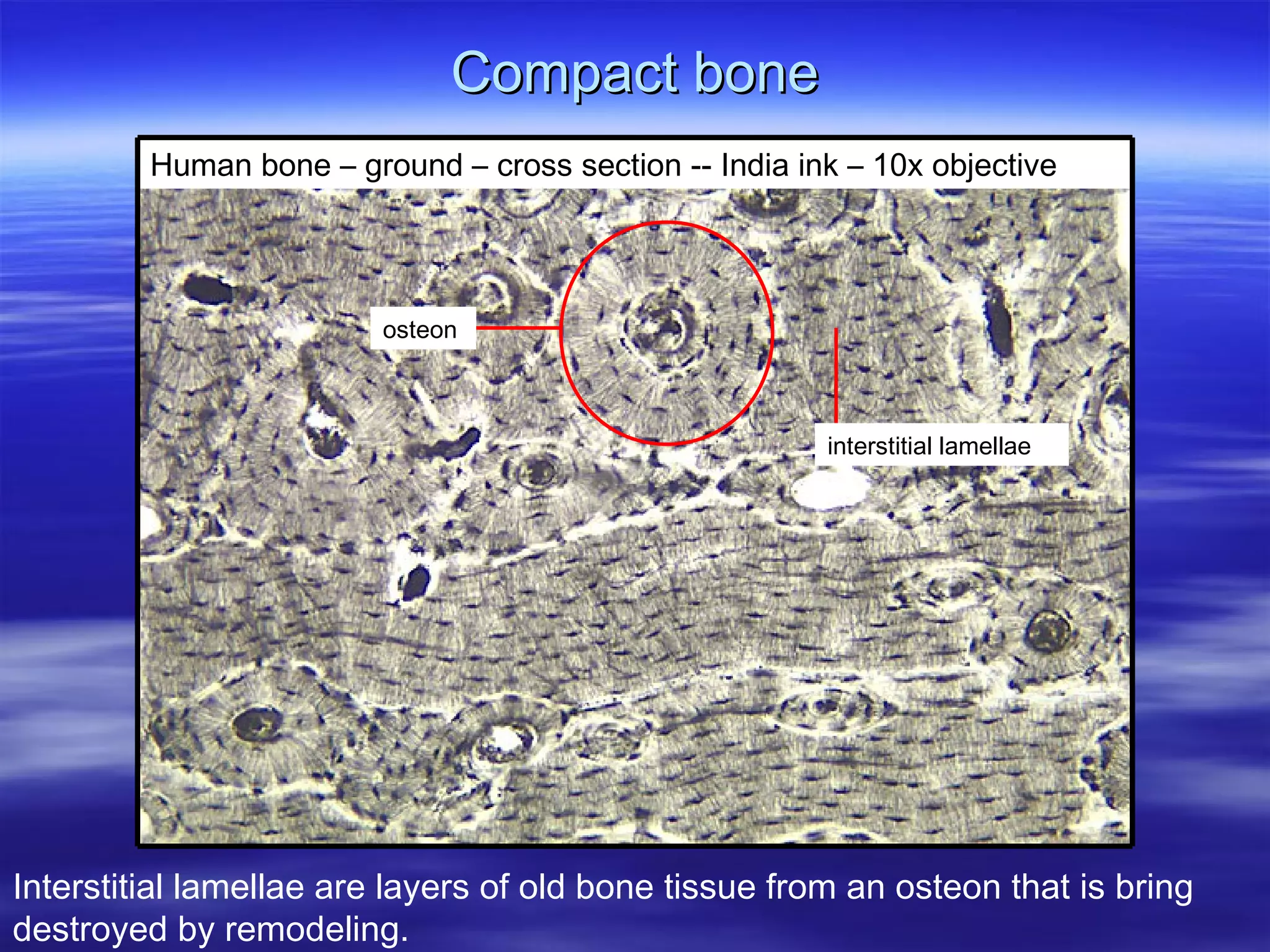 Histology: Bone | PPT