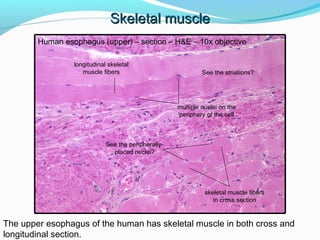 Skeletal Muscle Histology Labeled