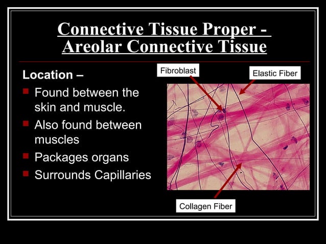 Histology 2 connective_tissue | PPT | Bone and Joint Conditions ...