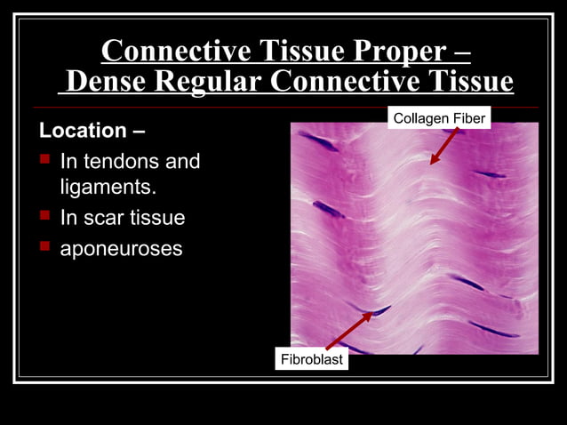 Histology 2 connective_tissue | PPT | Bone and Joint Conditions ...
