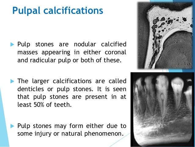 Histology and physiology of the pulp