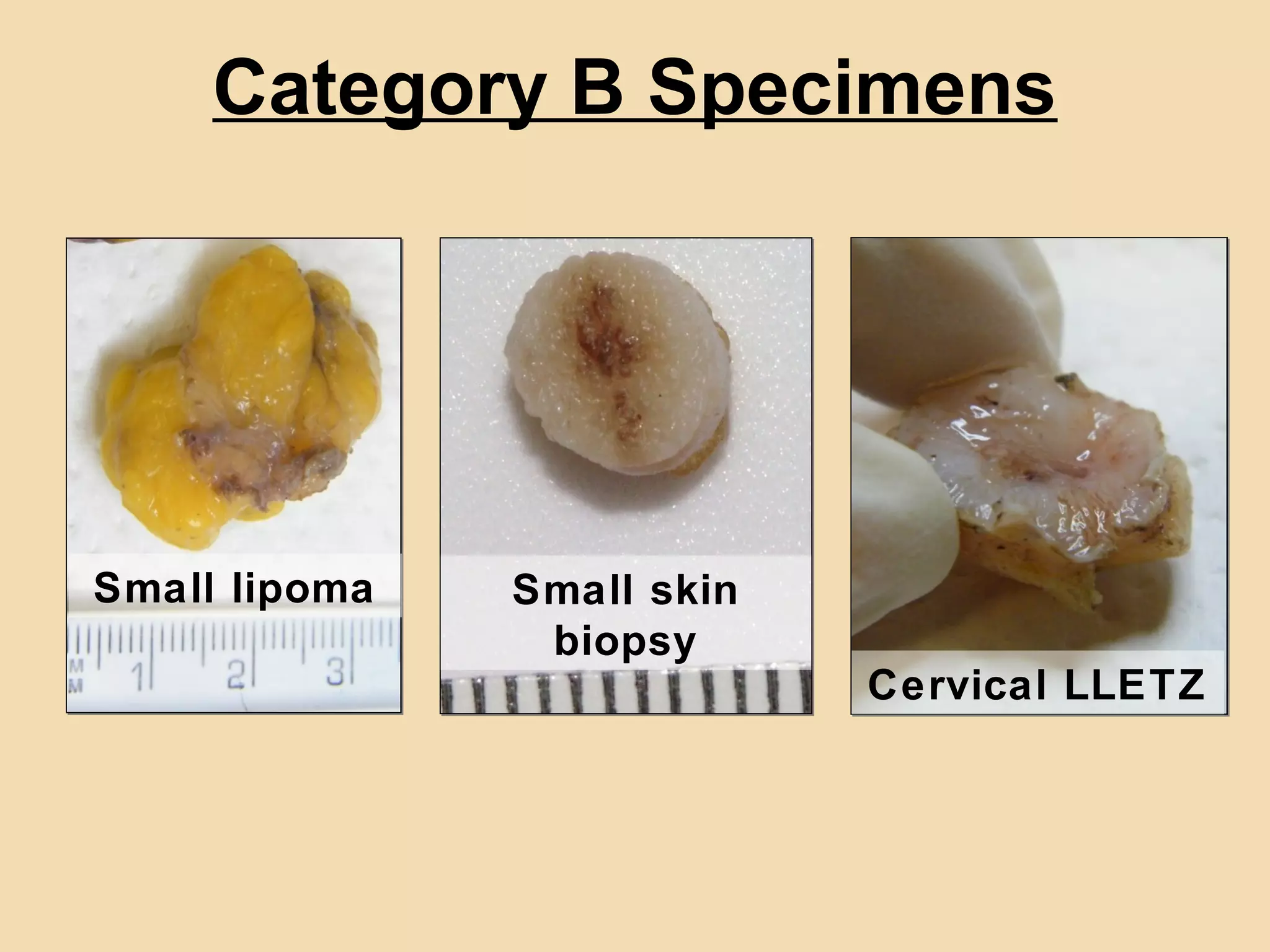 Histopathology In Practice - Sample Reception, Dissection, Processing, Embedding. | PPT