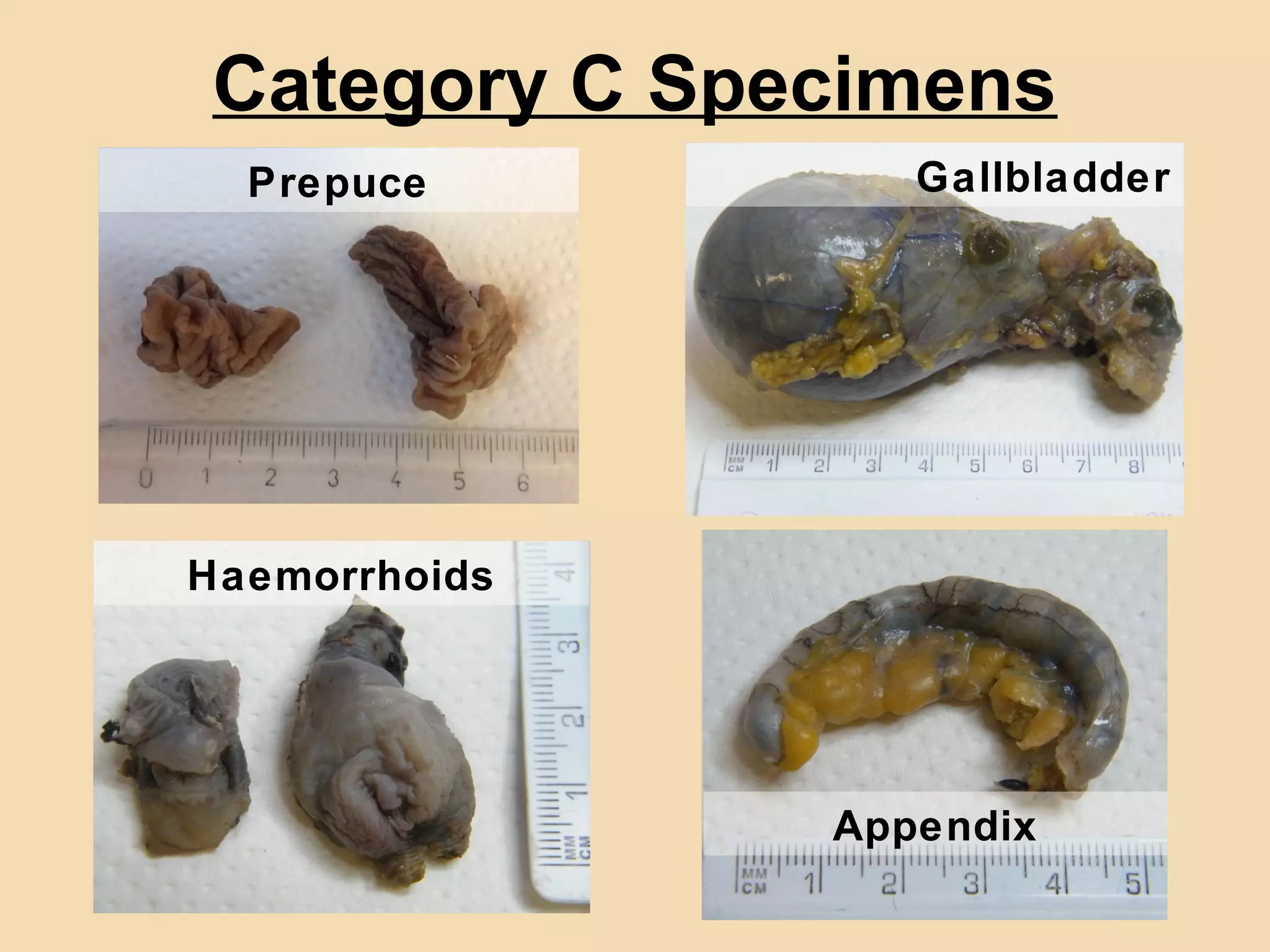 Histopathology In Practice - Sample Reception, Dissection, Processing, Embedding. | PPT