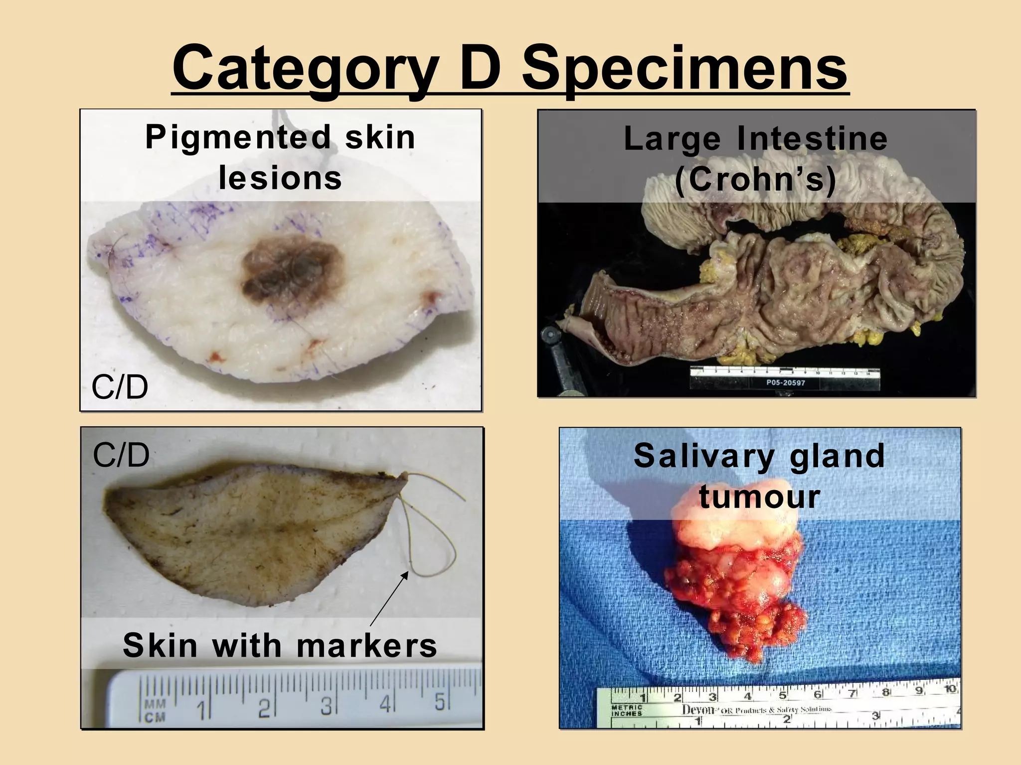Histopathology In Practice - Sample Reception, Dissection, Processing, Embedding. | PPT